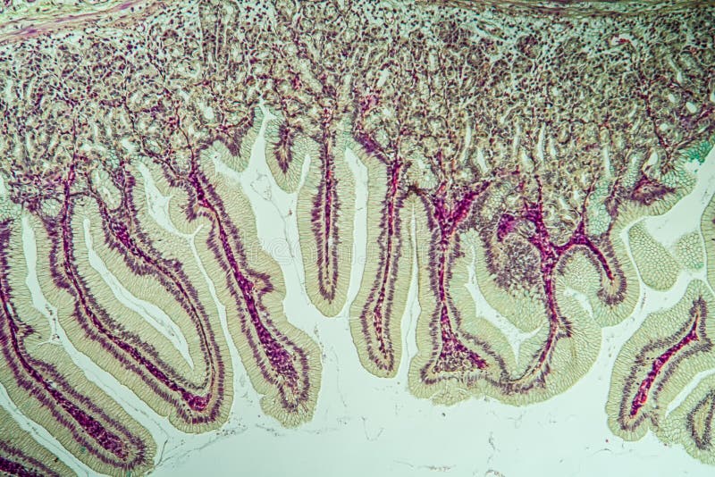 255 Large Intestine Histology Stock Photos - Free & Royalty-Free Stock ...