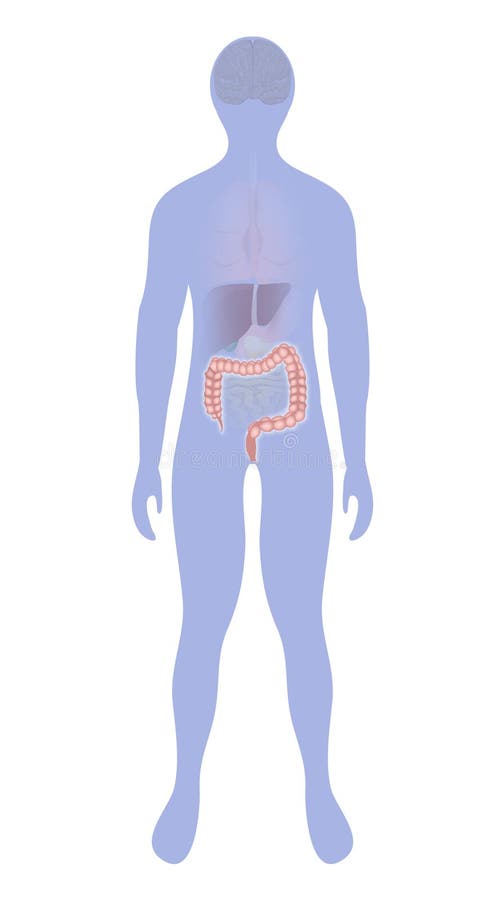 Hirschsprung Disease Stock Illustrations – 8 Hirschsprung Disease Stock ...