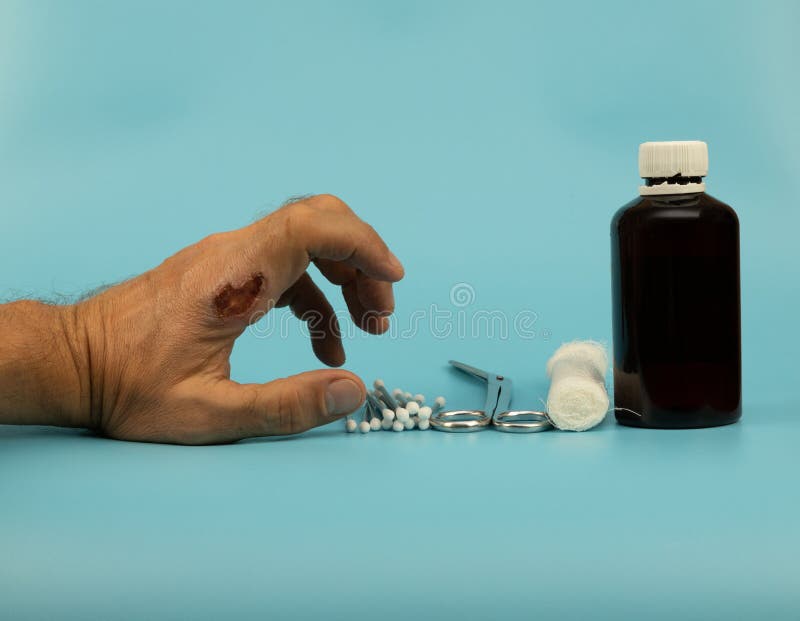 Large Open Wound on the Index Finger of a Man, Side View, Preparation ...