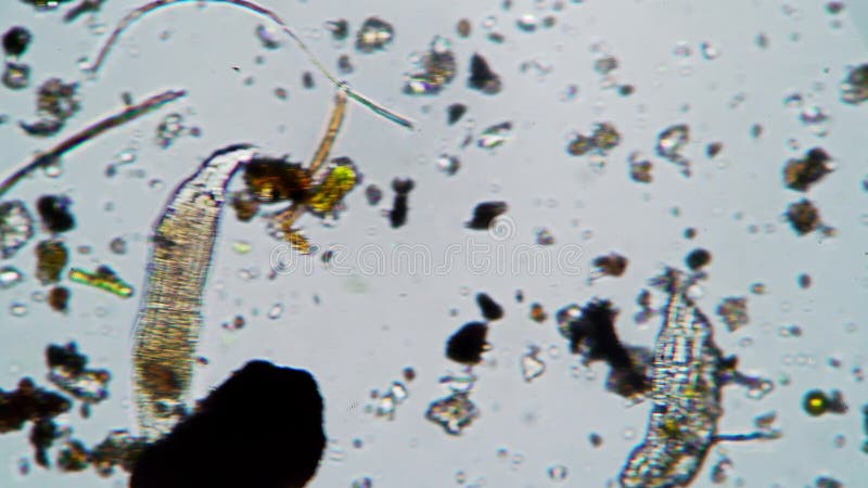 Rotifer Feeds in Dirty Water in a Microscope Stock Footage - Video of ...