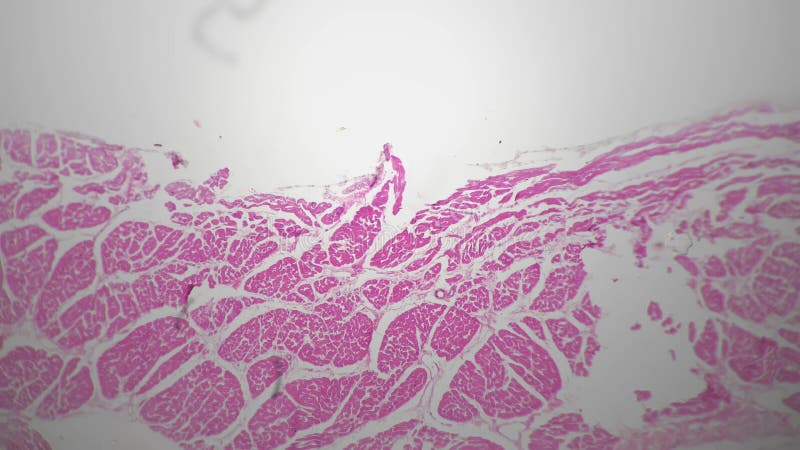 Large Vein Pattern in Section Filmed Under Microscope 40x on White ...
