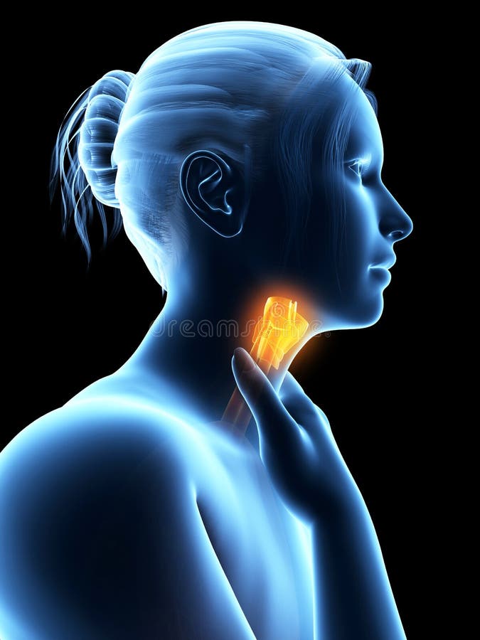 Laringe inflamada stock de ilustración. Ilustración de laringitis ...