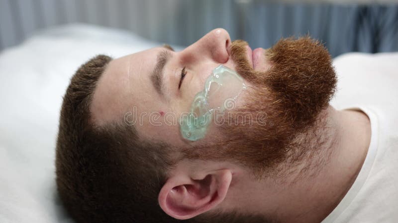 Laser Depilation is Performed on the Beard Contour To Achieve Clean ...