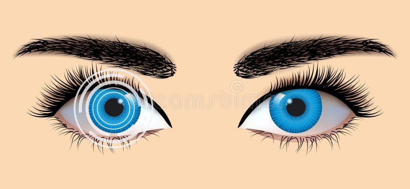 Laser Eye Surgery and Glaucoma Concept, Close-up of Eye with Grid Stock ...