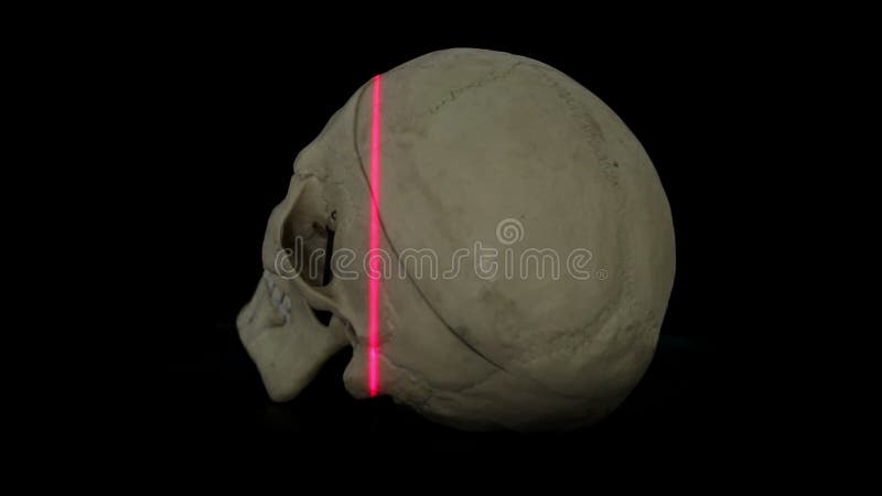 Laser Line Three Dimensional Scan of Human Skull Model Stock Video ...