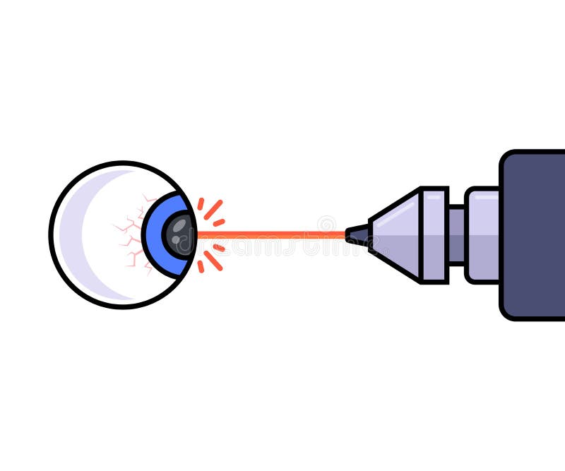 Laser Vision Correction Using a Laser. Stock Vector - Illustration of ...