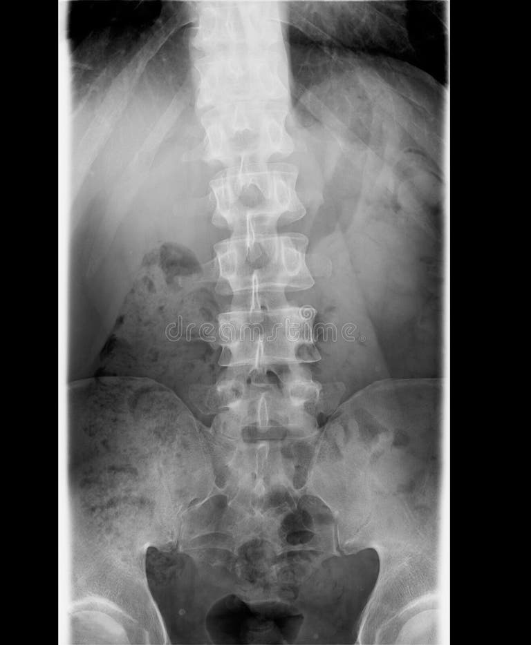 1,167 Hip Curve Stock Photos - Free & Royalty-Free Stock Photos from ...