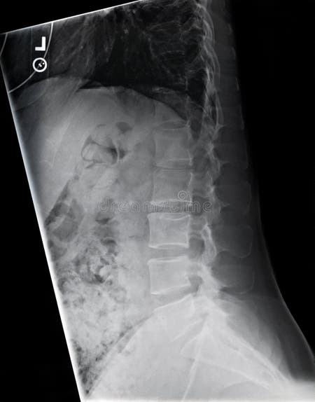 2,390 Sacrum Stock Photos - Free & Royalty-Free Stock Photos from ...