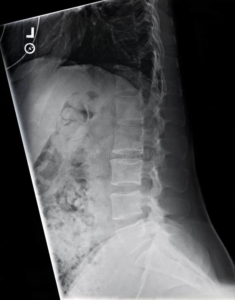 2,119 Sacrum Stock Photos - Free & Royalty-Free Stock Photos from ...