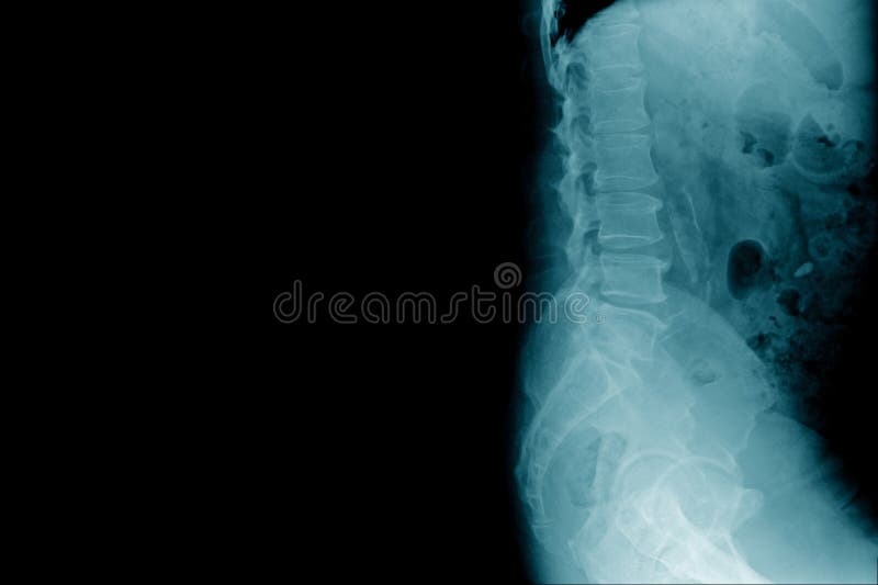 Lateral View of Human Spine Stock Image - Image of disc, body: 163438773