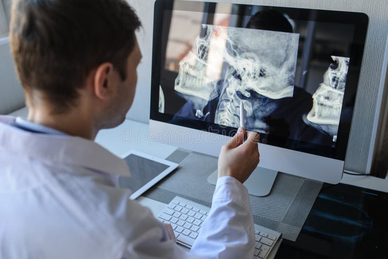 View of a Male Radiologist Examining Neck X-rays Cervical Vertebrae on ...