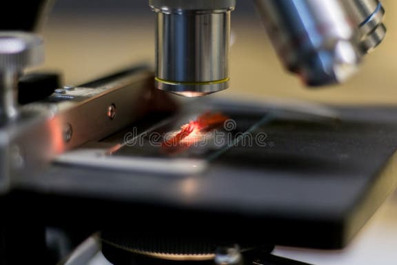 Lateral View of a Microscope while Analyzing an Intertwining of Threads ...