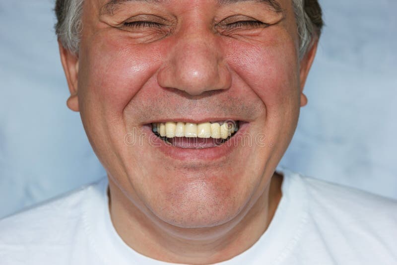 Laughing Man with False Teeth Stock Photo - Image of chin, completion ...