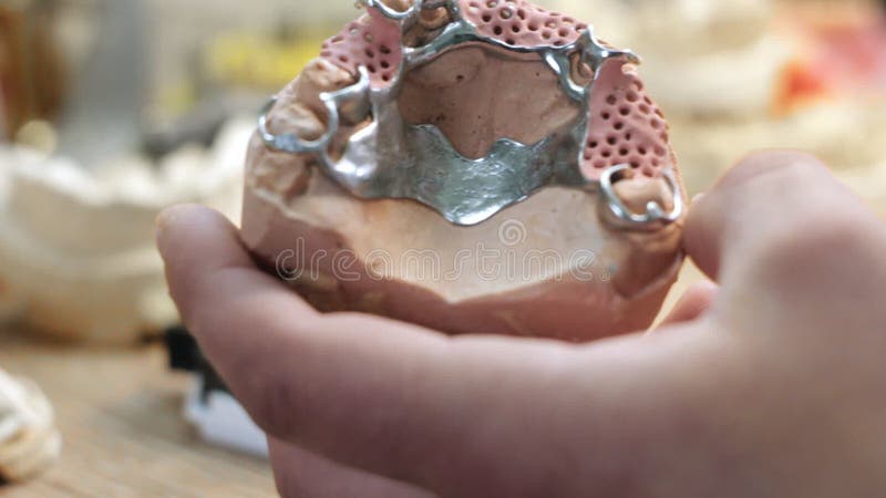 The Layout of the Denture in the Hands of Man and a Work Desk ...