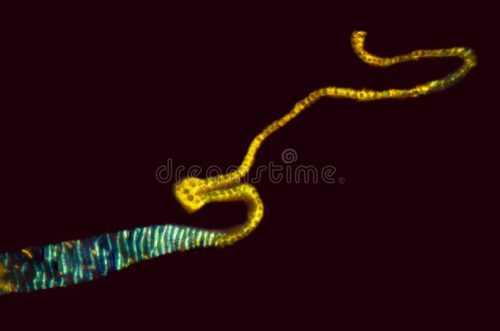Lazy String of a Cross Section of a Moss Leaf, Dicranum Stock Image ...