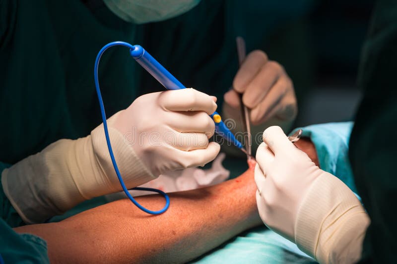 Le Chirurgien Font L'incision De Peau Photo stock - Image du pince ...
