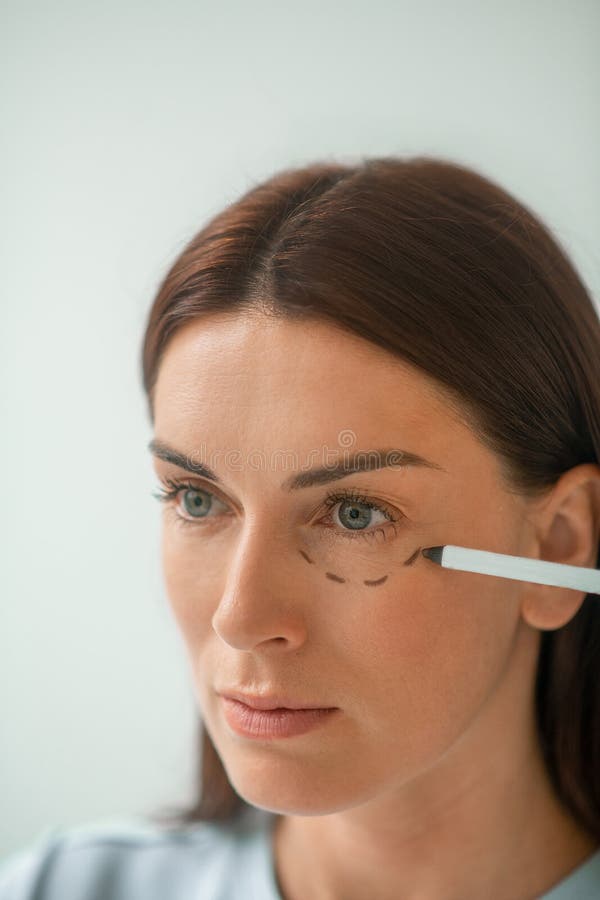 Le Chirurgien Plastique Dessine Des Lignes Sur Le Visage Des Clients