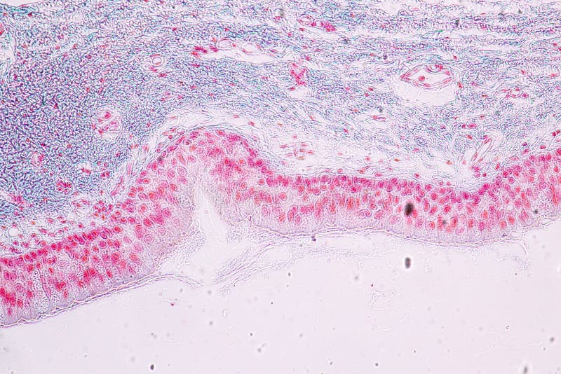 Learning Anatomy and Physiology of Pseudostratified Columnar Epithellum ...