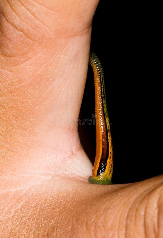 The Bite of a Leech. Bleeding Wound Stock Photo - Image of parasite ...