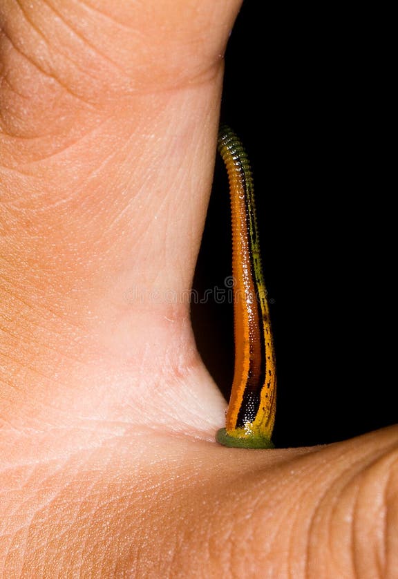 398 Leech Bite Stock Photos - Free & Royalty-Free Stock Photos from ...