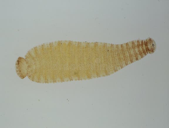 Leeches swim in the pond stock photo. Image of rtelwafrac14 - 194438068