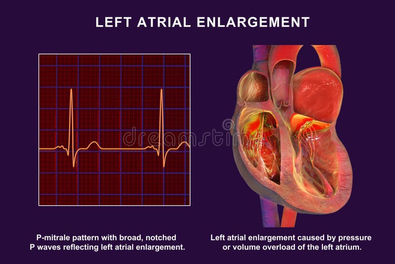 Mitrale Pattern Stock Illustrations – 7 Mitrale Pattern Stock ...
