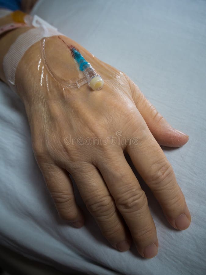 Hand of the patient. stock image. Image of nurse, body - 121344023