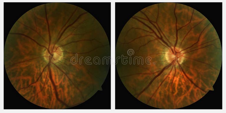 Scans Crops Stock Illustrations – 1,161 Scans Crops Stock Illustrations ...