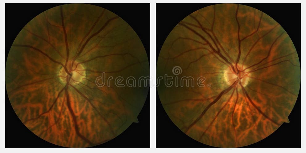 Scans Crops Stock Illustrations – 1,161 Scans Crops Stock Illustrations ...