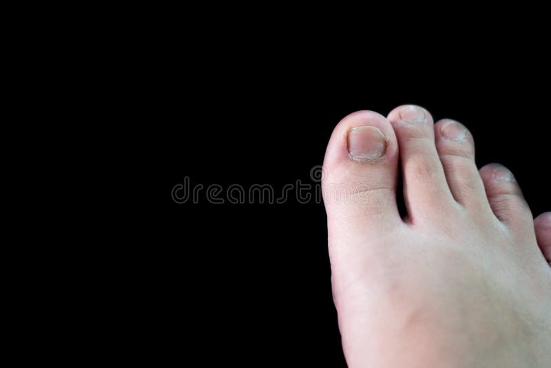 1,292 Left Right Foot Stock Photos - Free & Royalty-Free Stock Photos ...