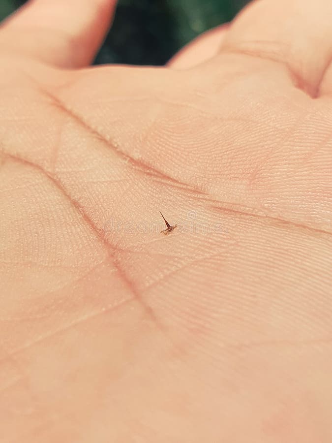 Leftover bee sting on hand stock photo. Image of stings - 263705438