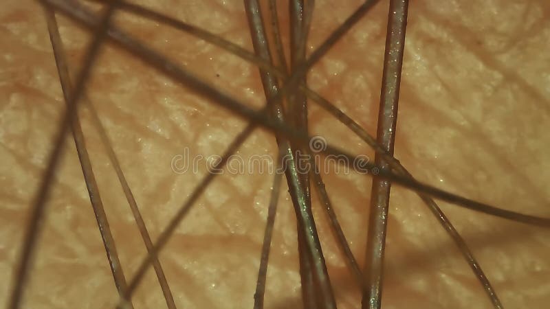 Leg Hair Under Microscope stock video. Video of human - 329104977