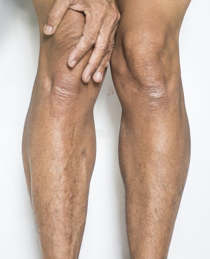 Male Anatomy Bones Muscles Stock Photos - Free & Royalty-Free Stock ...