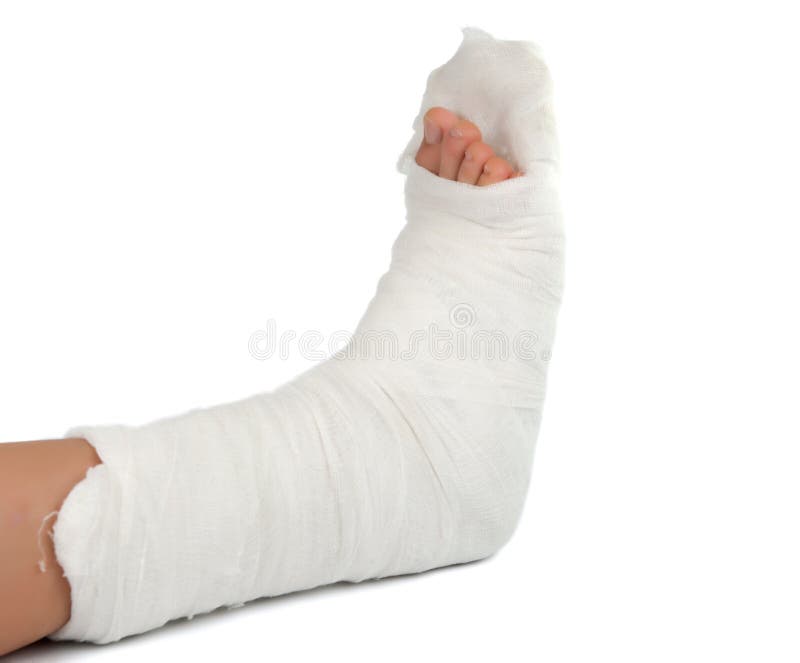 Full Body Plaster Cast