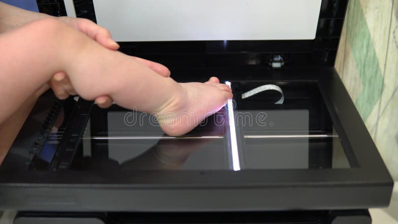 Leg Scan Process. the Scanner in Operation Scans a Child S Foot with ...