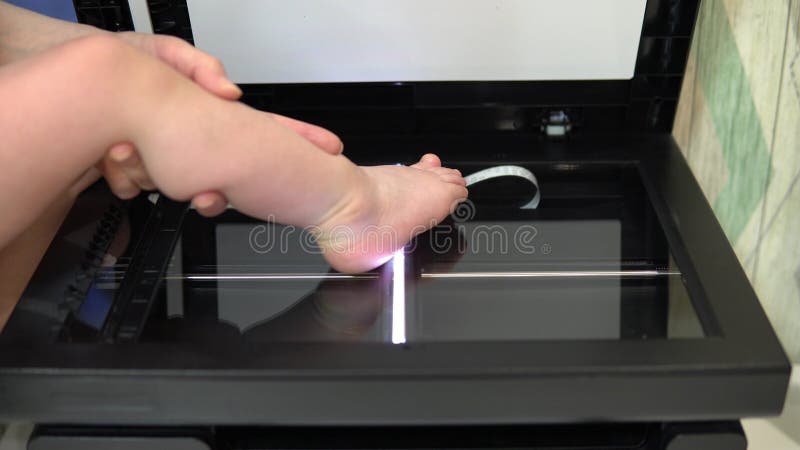 Leg Scan Process. the Scanner in Operation Scans a Child& X27;s Foot ...