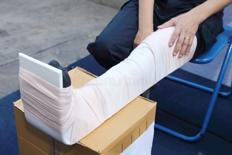 Leg with a splint stock image. Image of care, healthy - 48167255