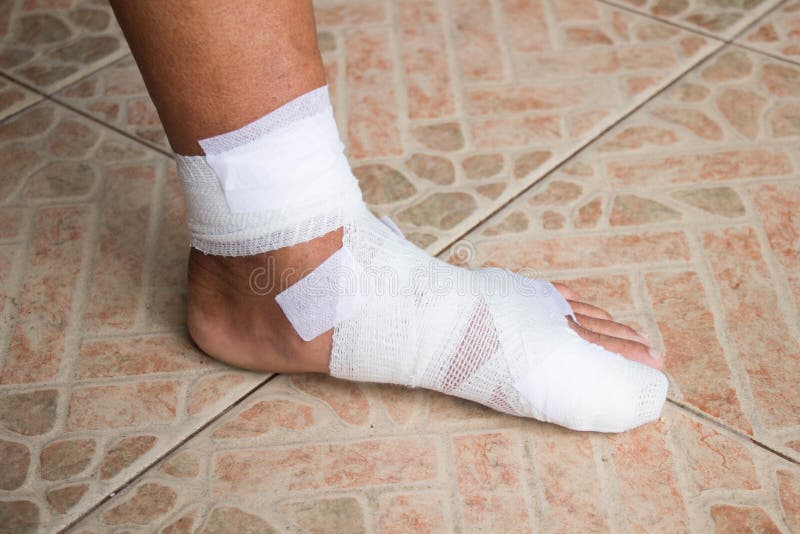 Doctor Bandaged Foot Of A Patient Stock Image - Image of happiness ...