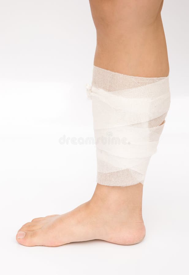 Leg wrapped with bandage stock photo. Image of injury - 28837670