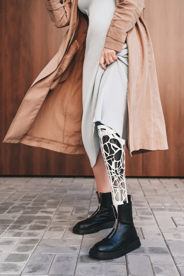 Legs of a Young Girl with a Bionic Prosthesis. Stock Photo - Image of ...