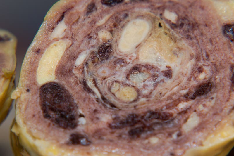 Leiomyoma of the Mesosalpinx in Chicken Stock Photo - Image of medical ...