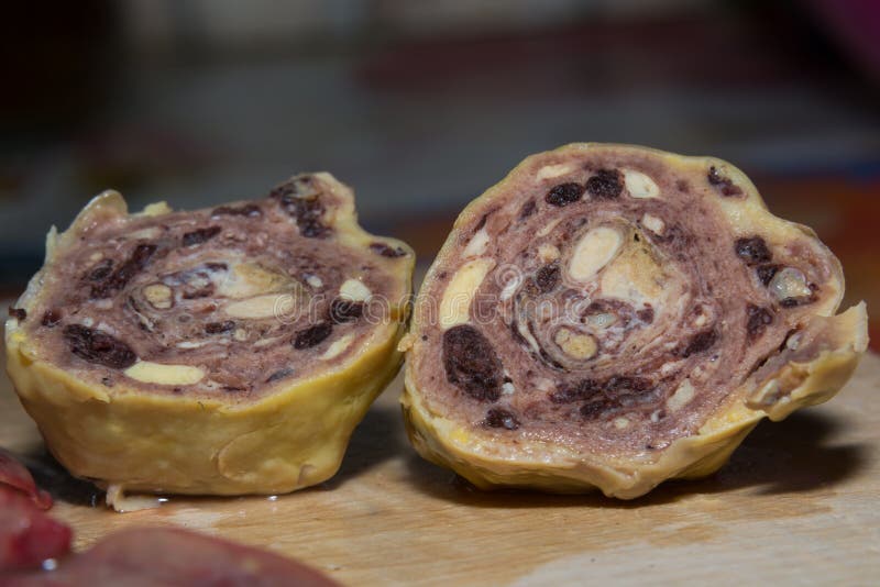 Leiomyoma of the Mesosalpinx or Lash Egg Stock Image - Image of ...