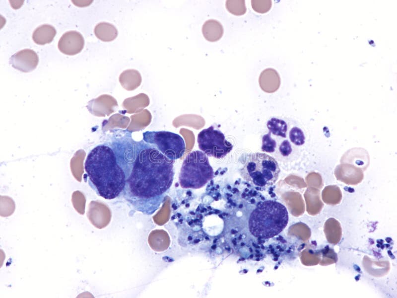 Leishmaniasis in Bone Marrow. Stock Photo - Image of parasites ...