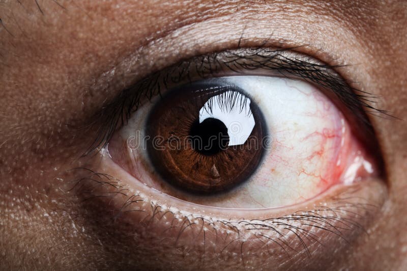 Lelijk oog stock foto. Image of wimpers, hoofd, vrees - 14817316