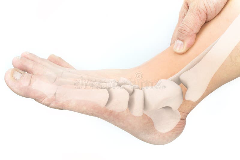Lesione Delle Ossa Di Piede Immagine Stock - Immagine di artrite ...