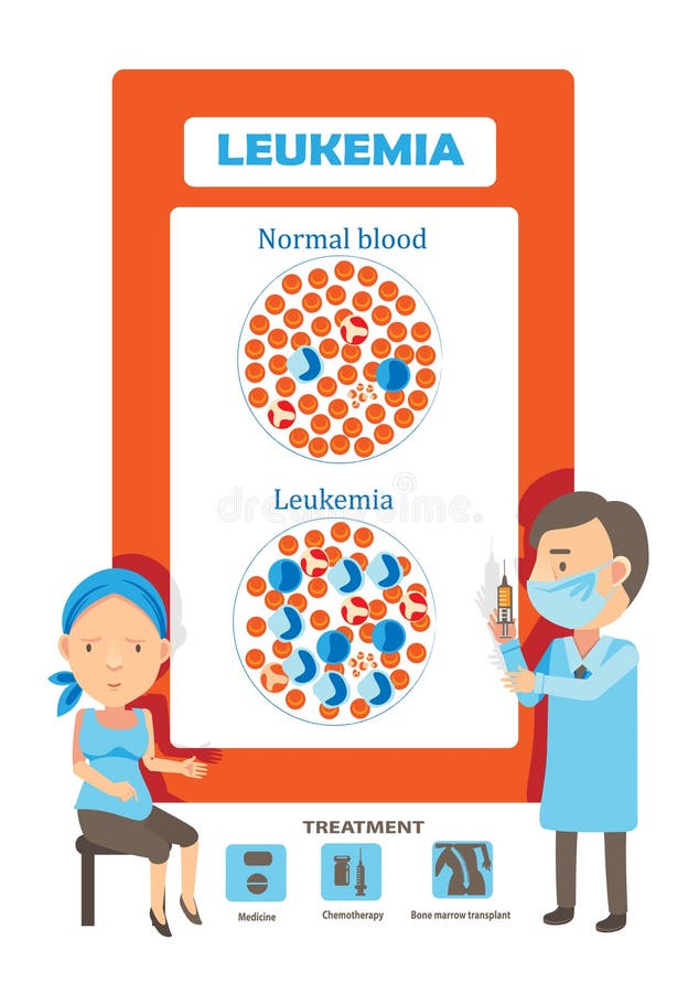 Ejemplo Del Vector De La Leucemia Cáncer De Sangre Educativo Etiquetado ...