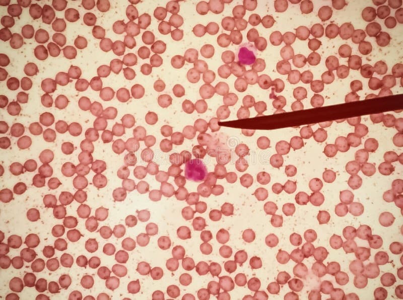 Globuli bianchi normali fotografia stock. Immagine di esame - 97101622