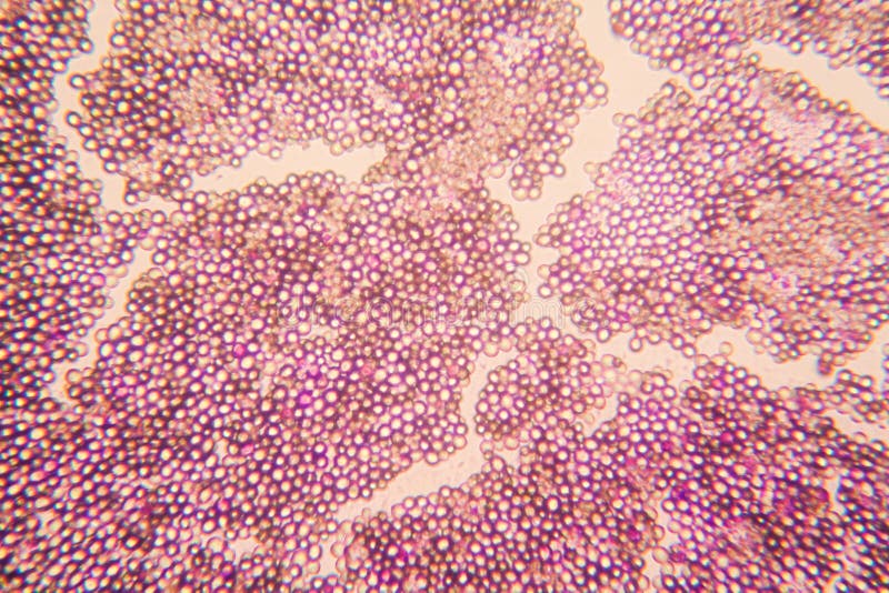 Levadura en el microscopio foto de archivo. Imagen de hongo - 111147648