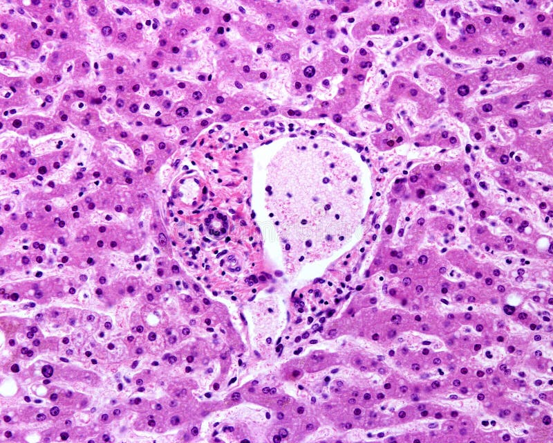 Hepatocyt is Cel Van Het Belangrijkste Parenchymweefsel Van De Lever ...