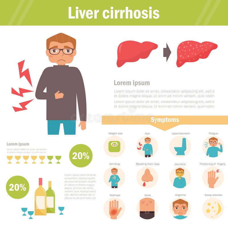 Levercirrose Vector vector illustratie. Illustration of hepatitis ...